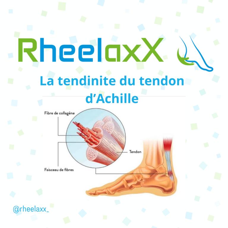 Tendinite du talon : causes et traitements simples